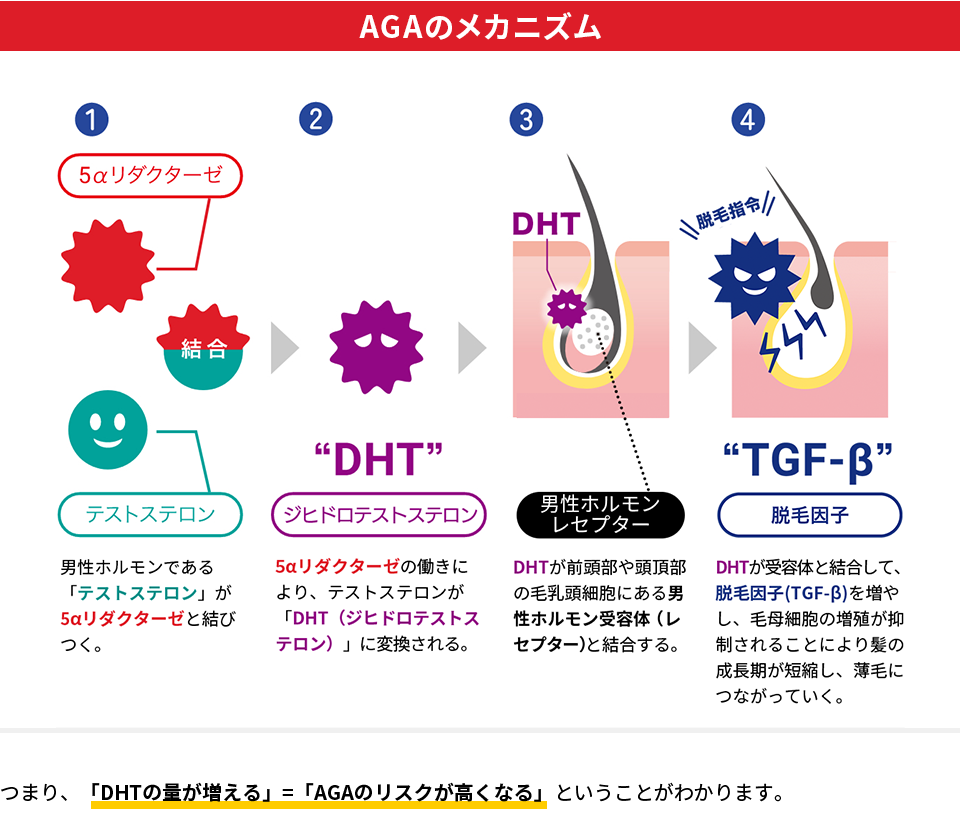 髪の毛たった5本でAGAによる薄毛のリスクをチェック！！｜アートネイチャーAGAリスク検査キット｜アートネイチャー